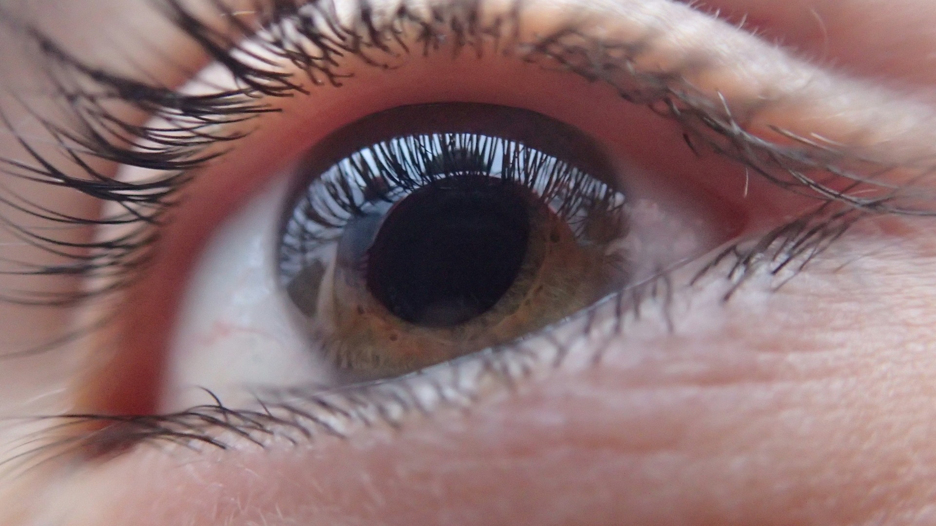 Myopia Control in Austin, TX | Arbor Eye Center